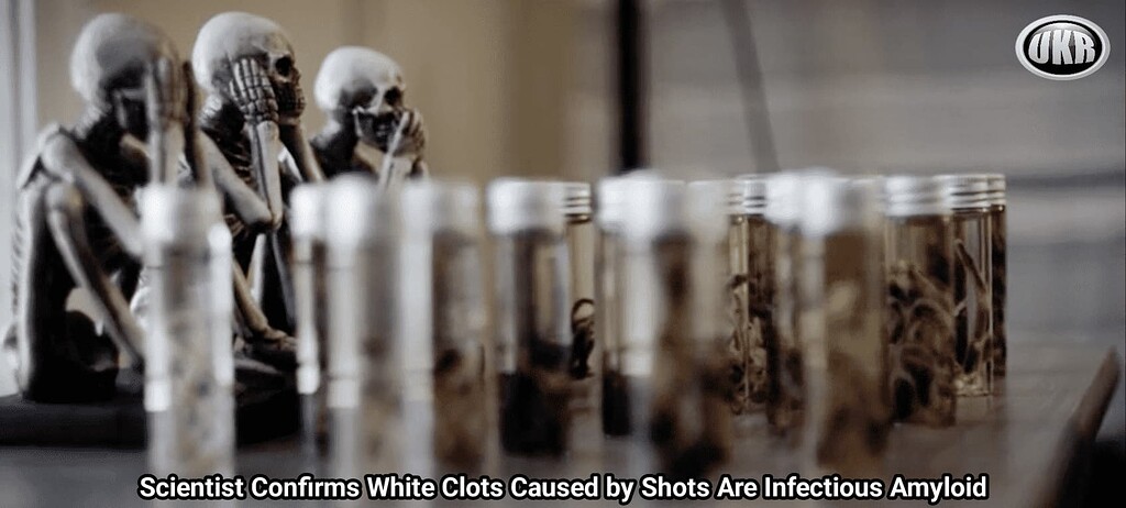 Scientist Confirms White Clots Caused by Shots Are Infectious Amyloid ...